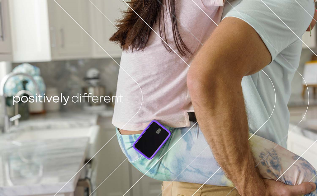 The next evolution of Tandem is ‘Positively Different’