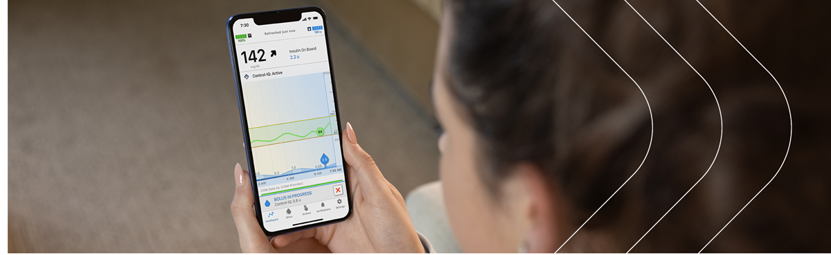 Tandem Mobi Try It Kit | Tandem Diabetes Care
