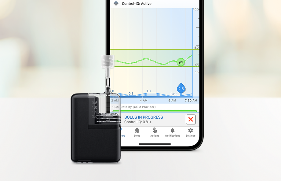 Insulin Pump Cost & Coverage | Tandem Diabetes Care