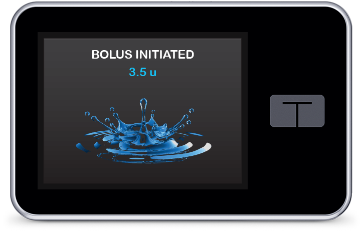Insulin Pumps and Diabetes Management | Tandem Diabetes Care