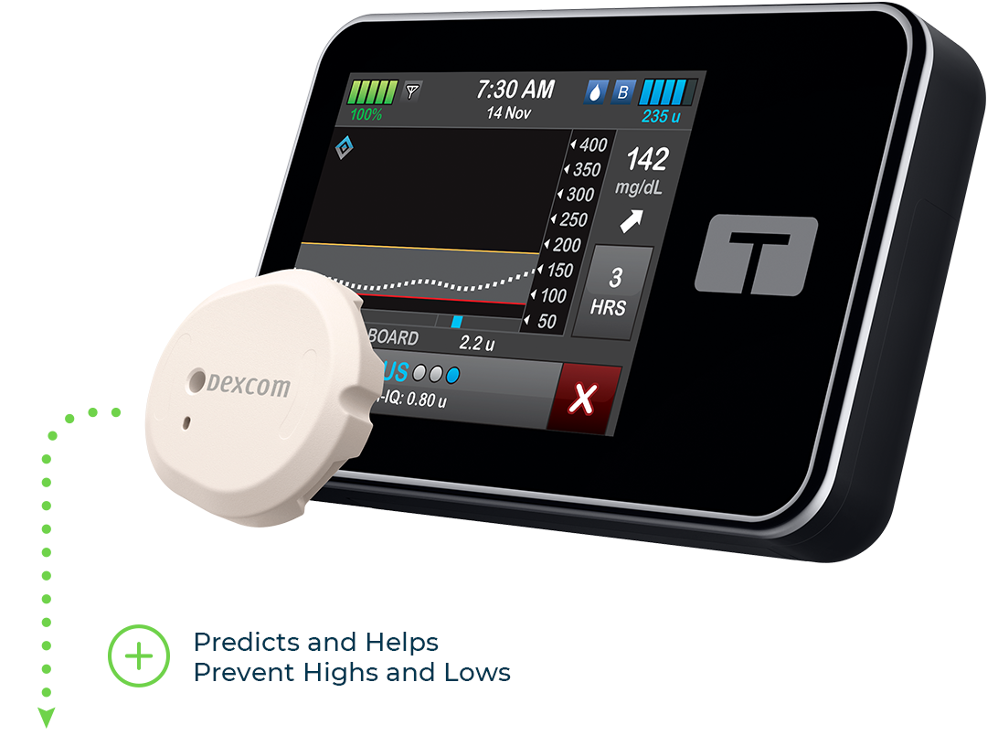 Dexcom G7 Cgm And T Slim X2 Pump Integration Tandem Diabetes Care