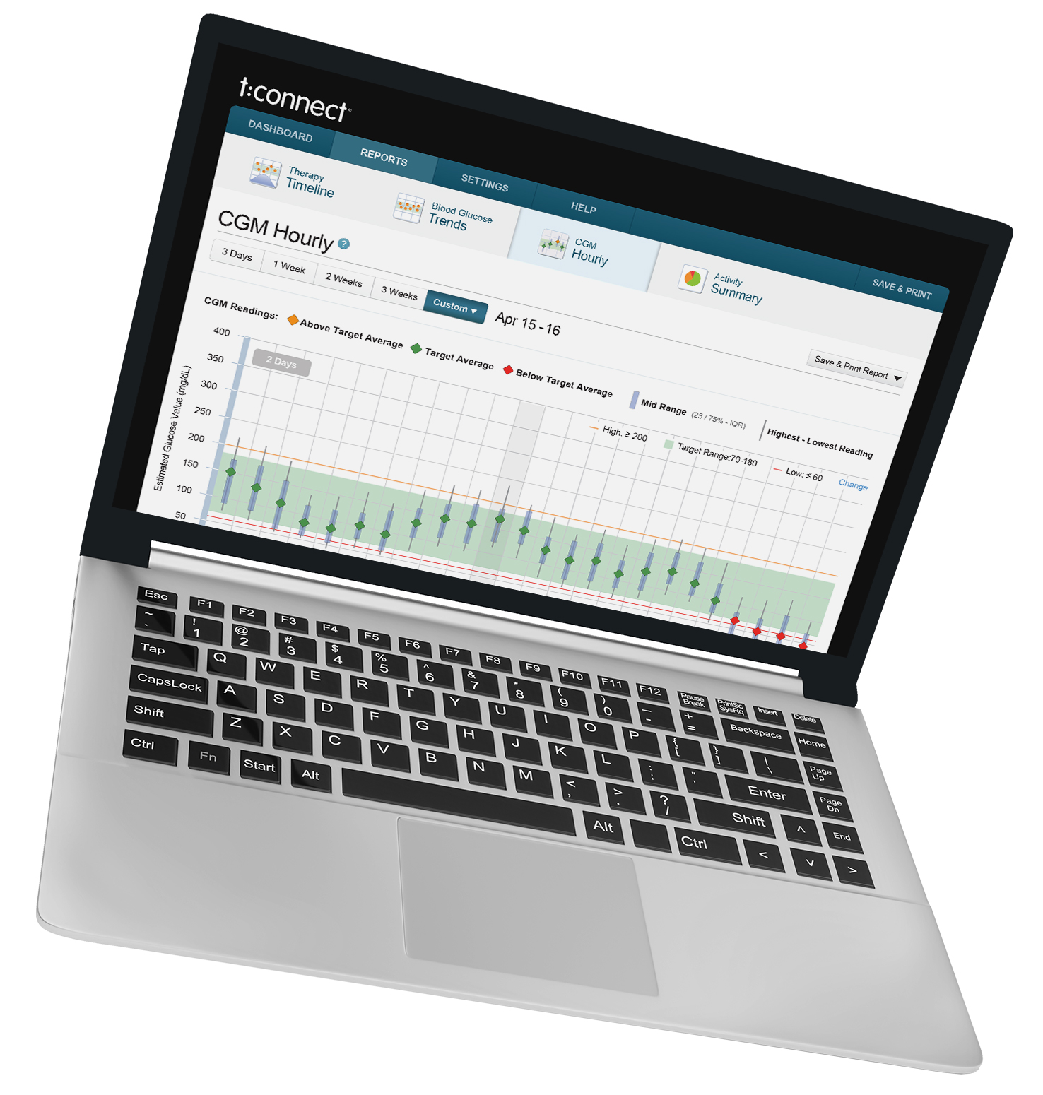 t:connect Web Application | Tandem Diabetes Care t:connect Web Application | Tandem Diabetes Care